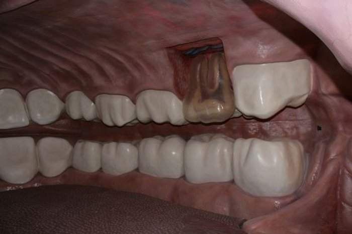 Corpus Museum in Netherland – A Voyage Through The Human Body | Amusing ...